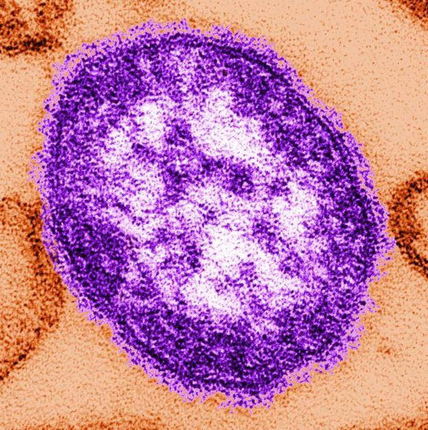 Measles case found in California after they passed through San ...