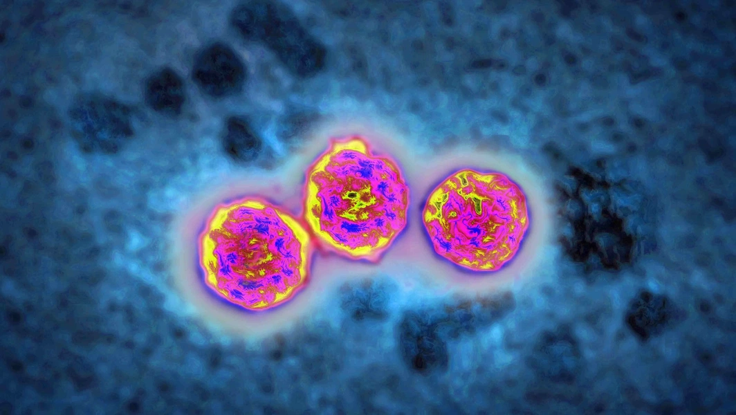 HBV and HCV linked to most global liver cancer cases
