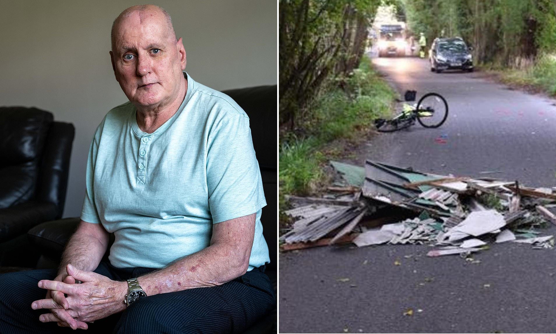 Cyclist, 66, had a quarter of his skull removed after hitting a fly ...