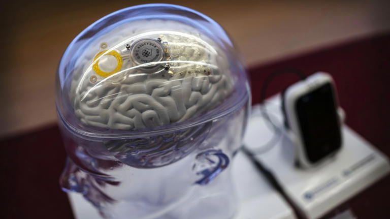 China just beat Neuralink with a commercial brain chip that can be ...