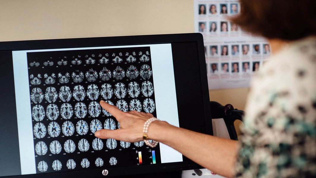 Experts link late-night scrolling to rising brain fog and poor focus