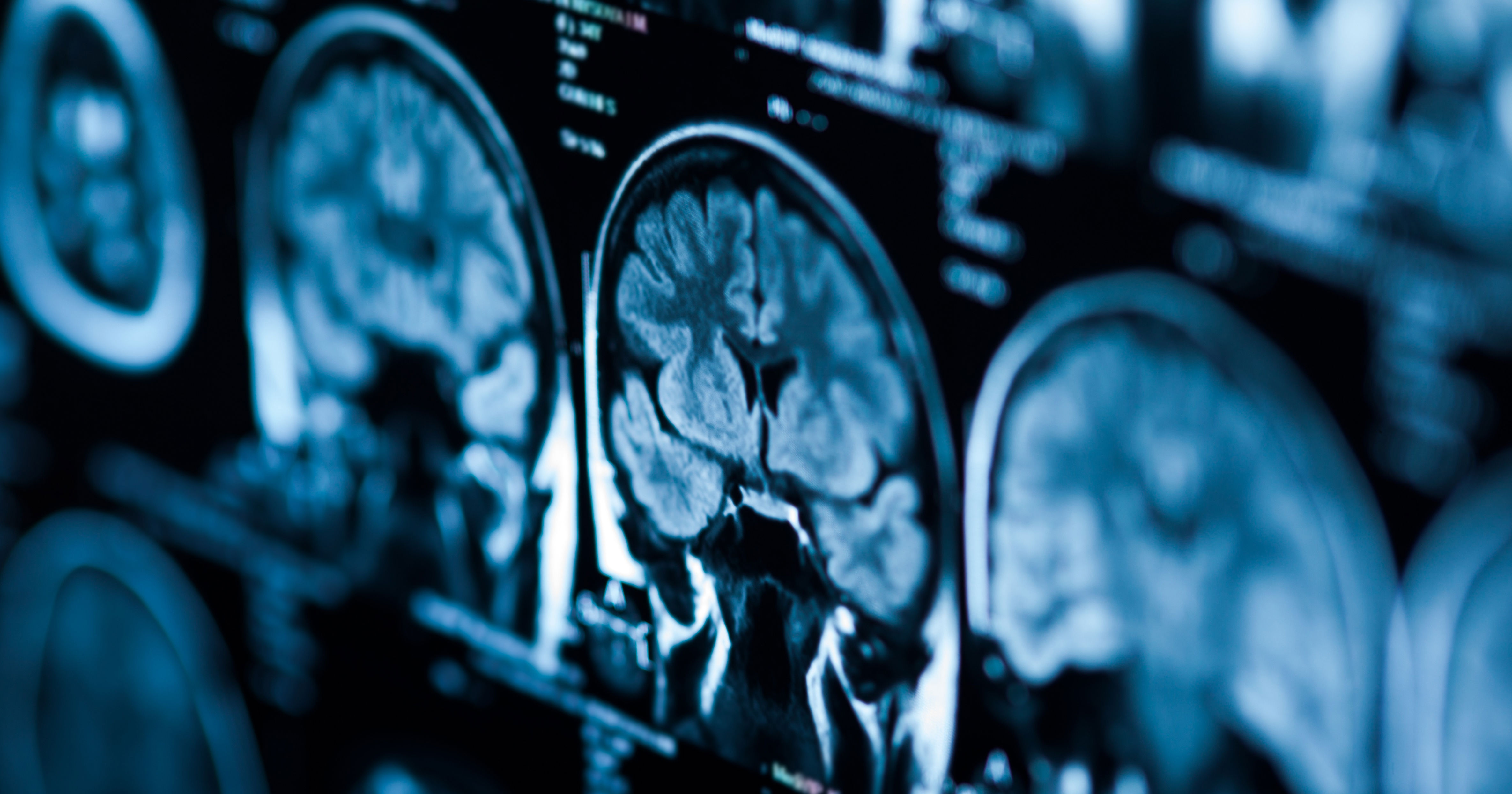 AARP Virginia: Socializing, healthy diet important for brain health