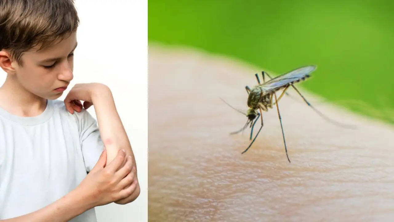 World Dengue Day: Why mosquitoes bite some people more than others