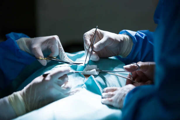Curved Surgery Mistakes That Can Change Your Life