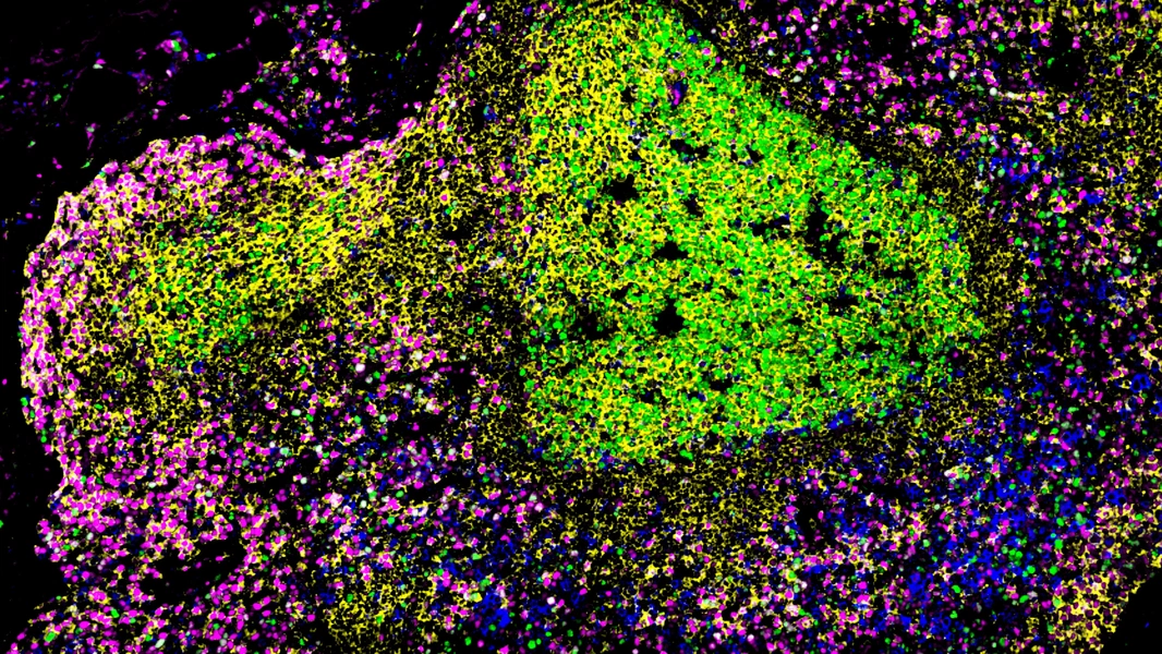 Understanding your lymph nodes and health signals