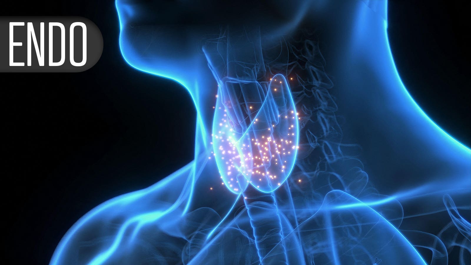 Diabetes tied to higher death risk after solid organ transplant