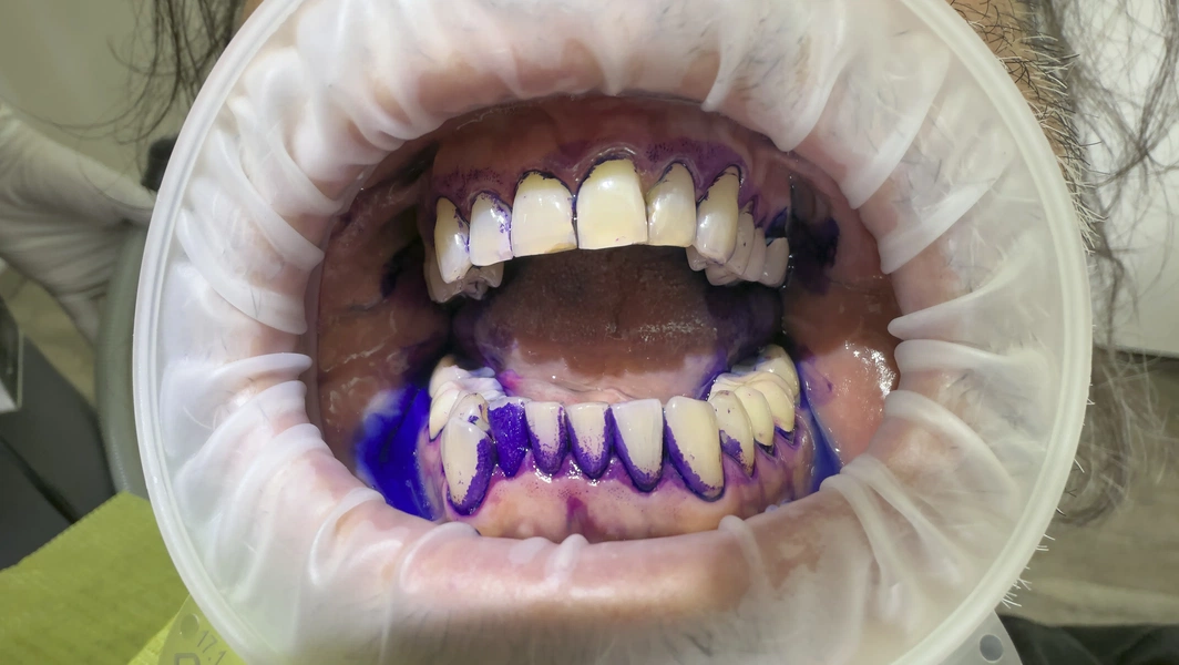 Small daily habits for a healthier smile