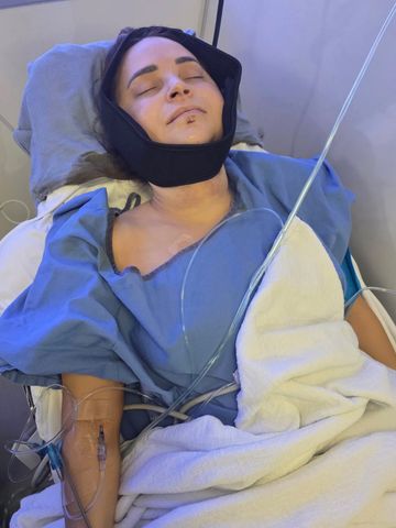 YouTuber Rosanna Pansino reveals she broke her jaw and teeth after ...