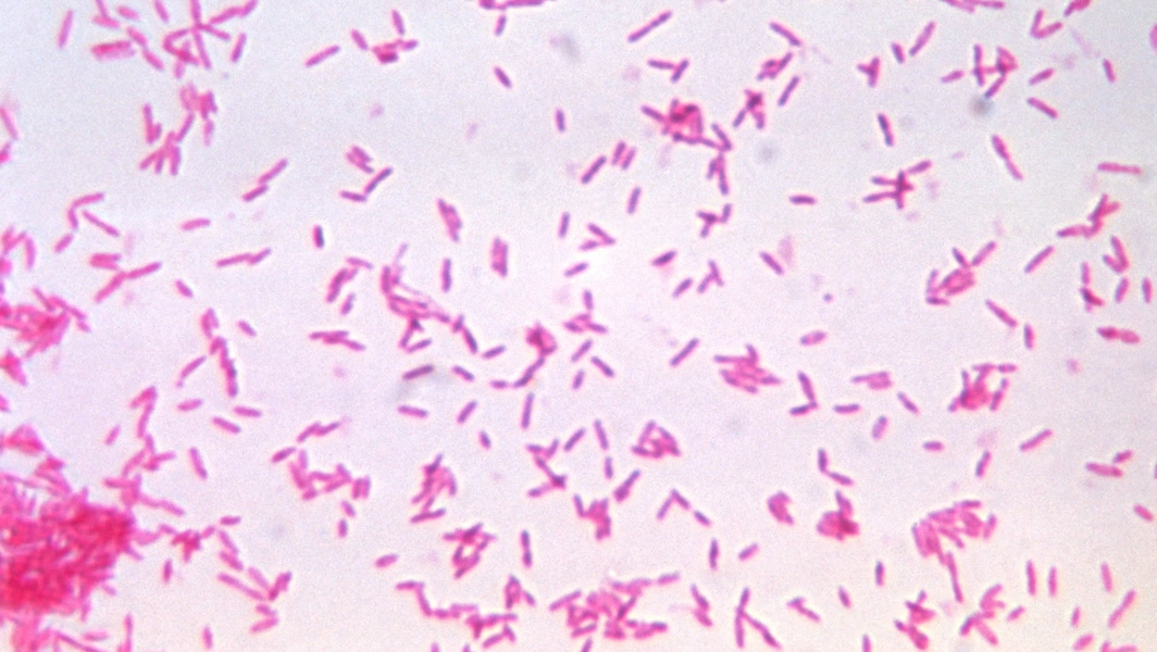 New microbiome insights point to targeted probiotic strategies