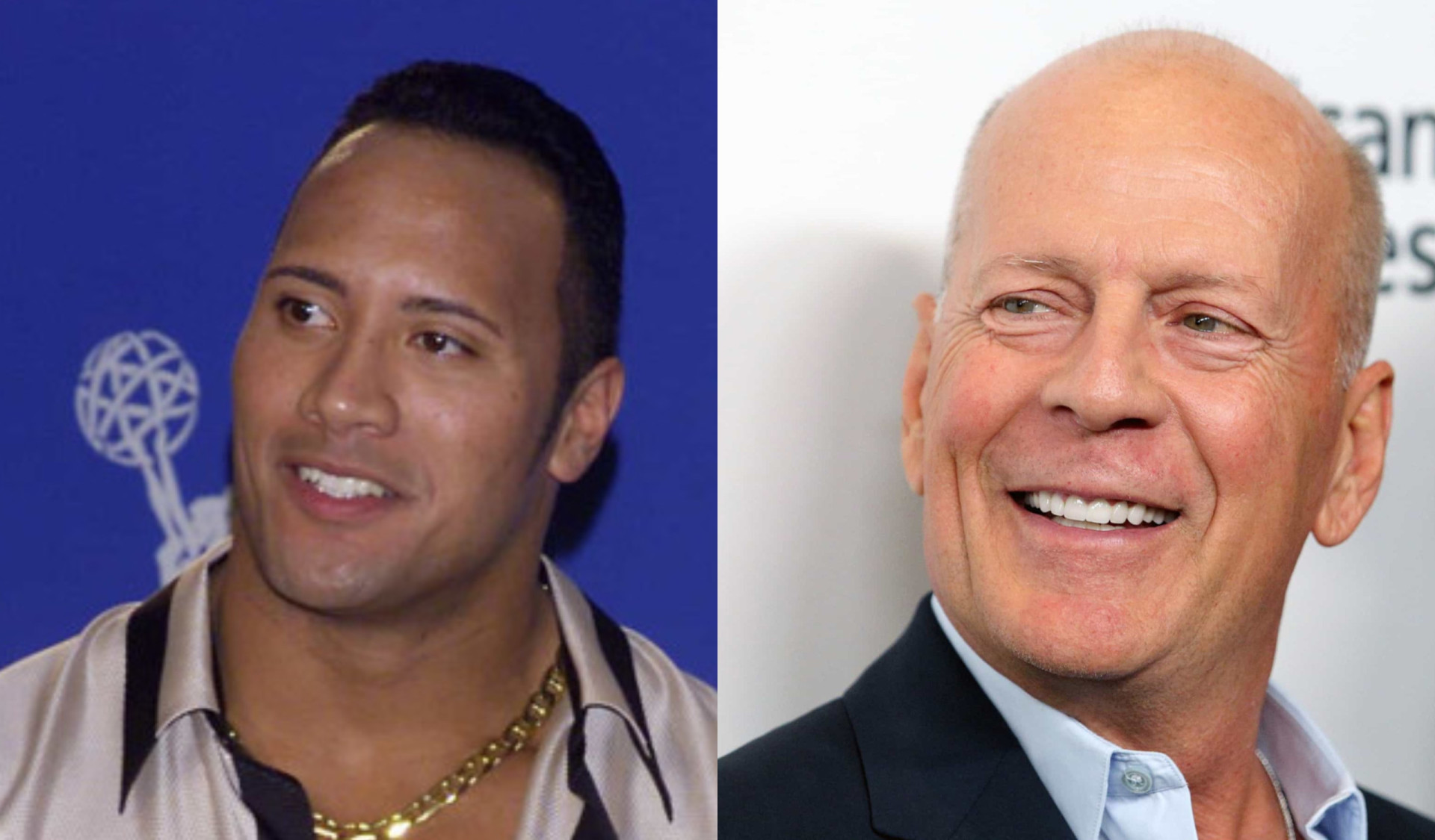 Bald celebrities when they had hair