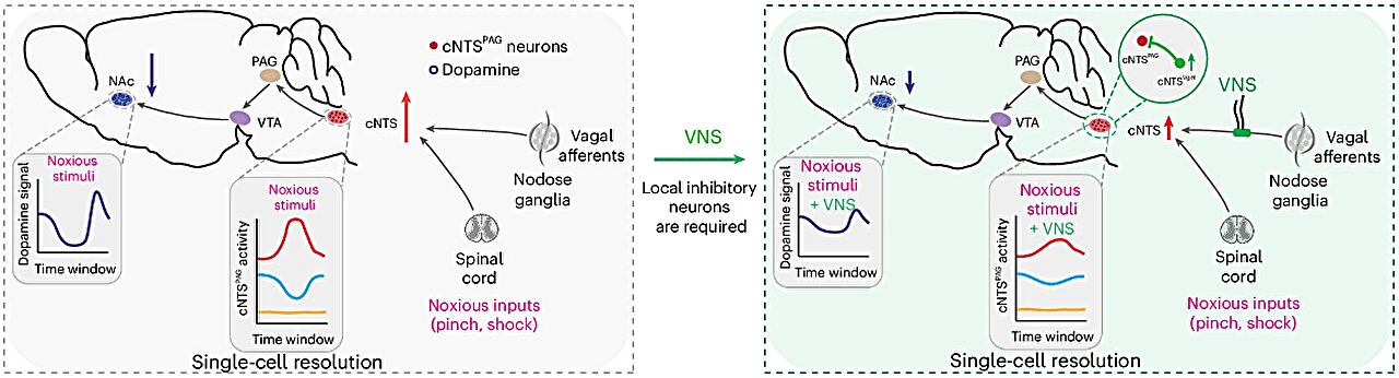 Vagus nerve stimulation may quiet pain through newly mapped brainstem ...
