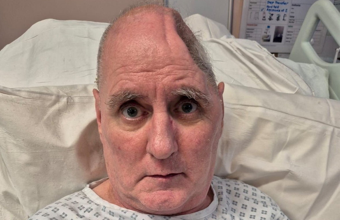 Cyclist’s skull partially removed after hitting fly-tipped shed on ...