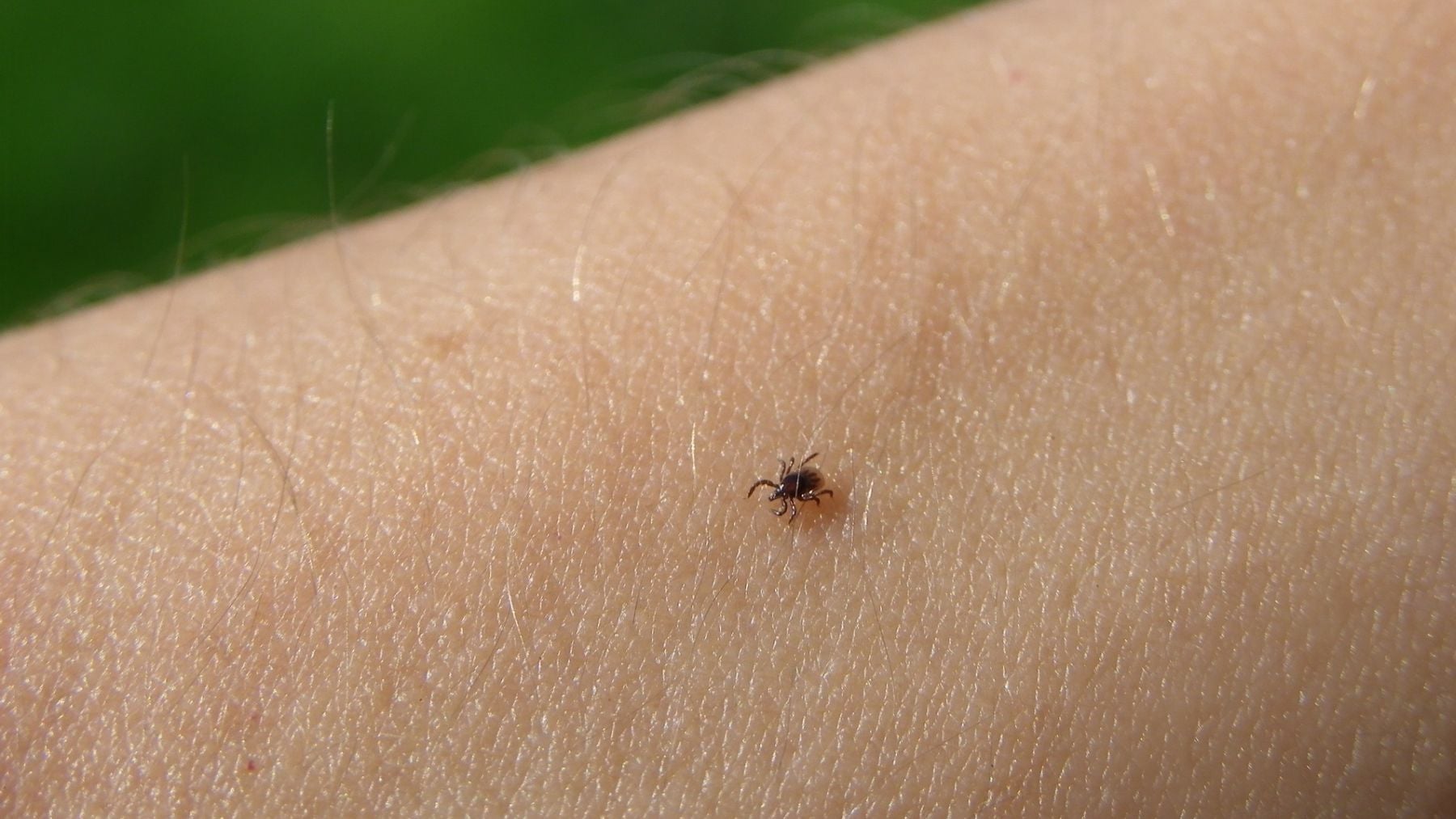 Confirmado un caso de fiebre hemorrágica de Crimea-Congo por picadura ...