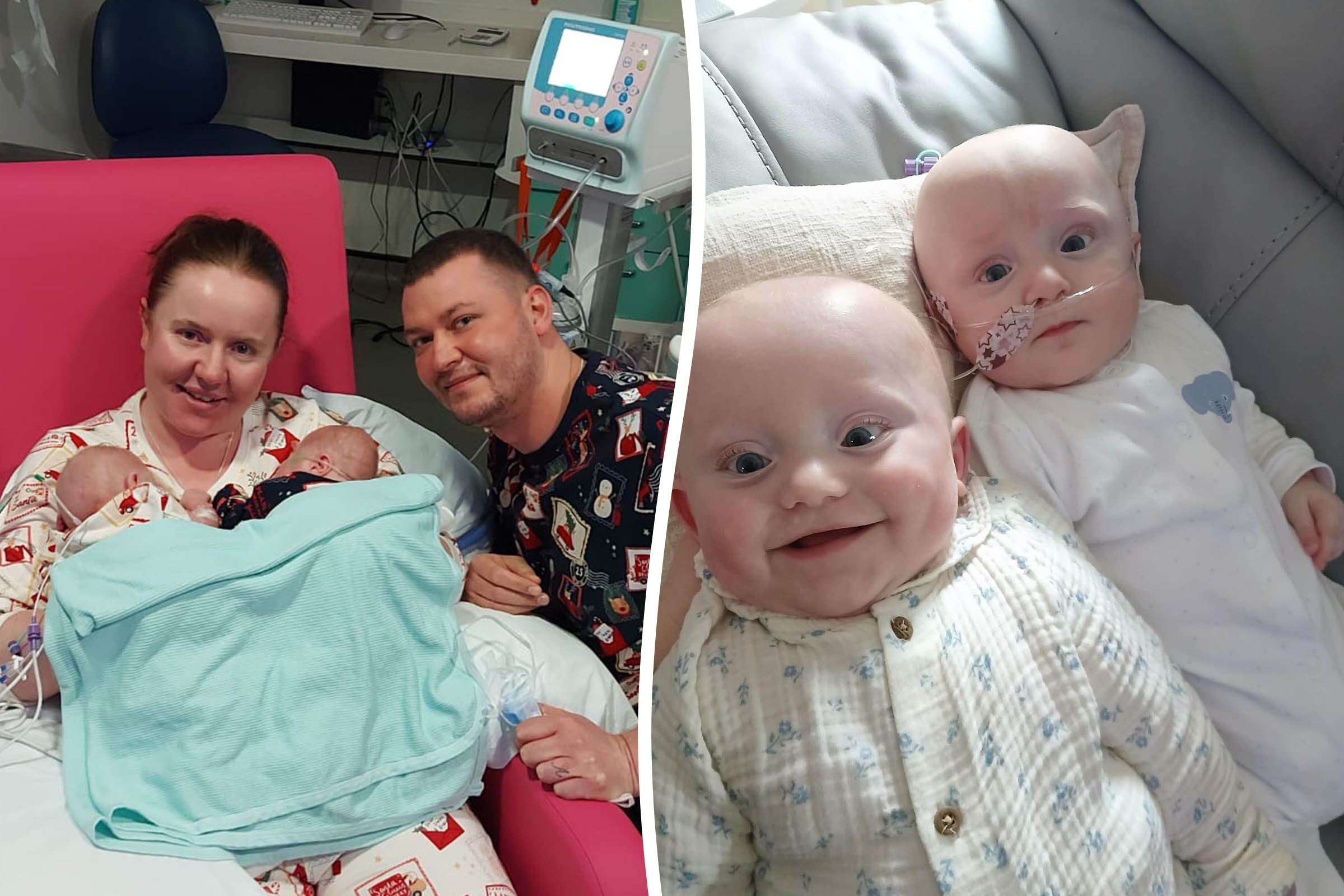 Twins born with hands the size of their dad’s fingernail spent 8 months ...
