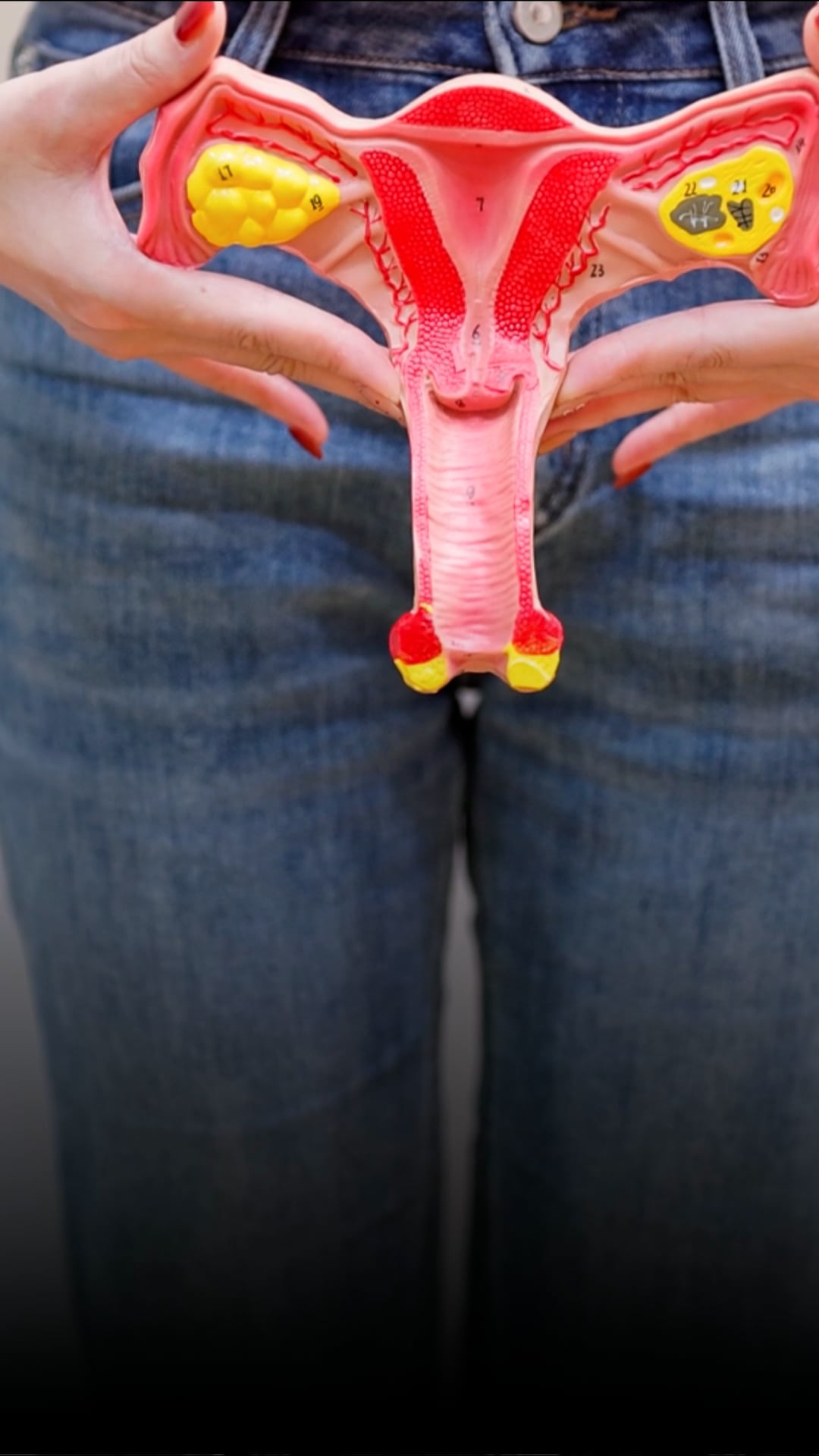 Un estudio identifica una bacteria presente en el 64% de las mujeres ...