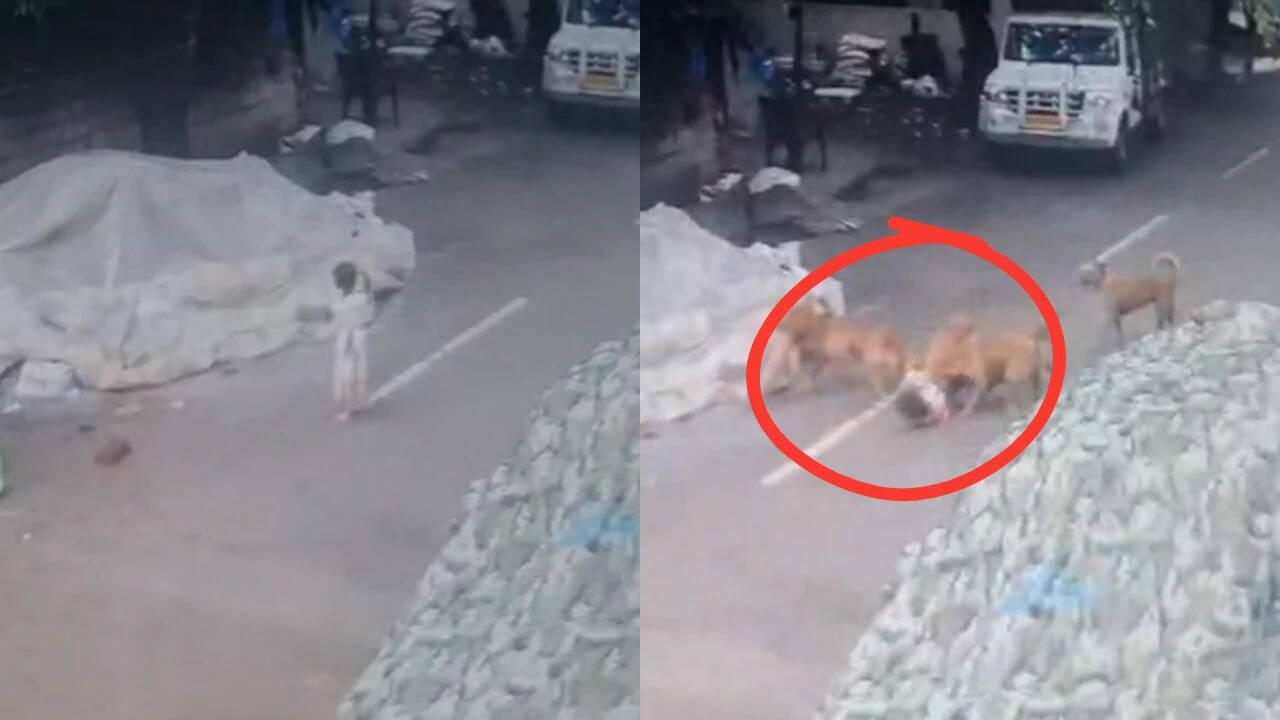 4-year-old girl injured in stray dog attack in Bengaluru; chilling ...