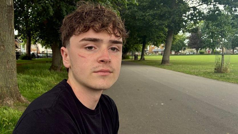 Stabbing survivor says bleed kit can save lives