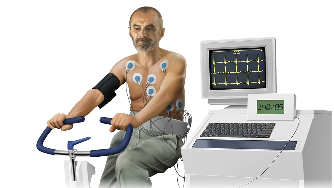 Marathon running triggers measurable but modest heart changes