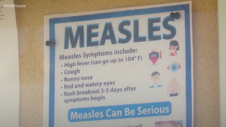 First measles case of 2026 confirmed in Connecticut