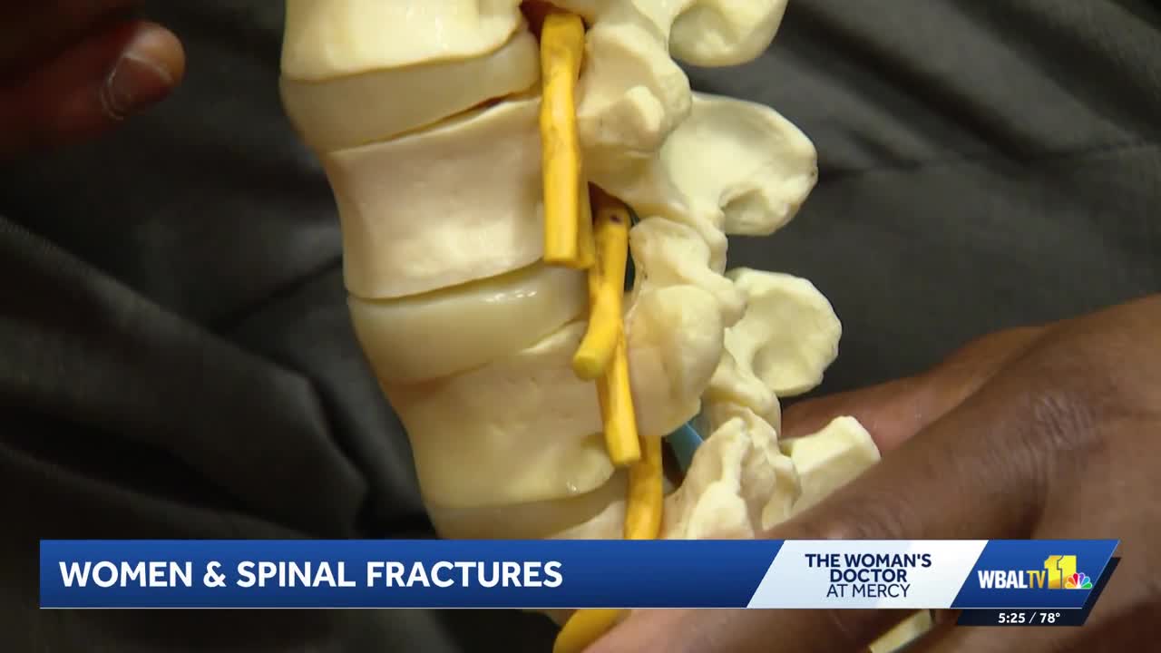 Older women at greater risk for spinal fractures