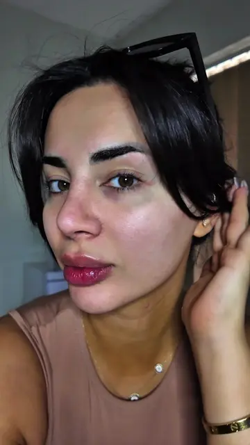 Inside my microneedling facial for smooth glowing skin