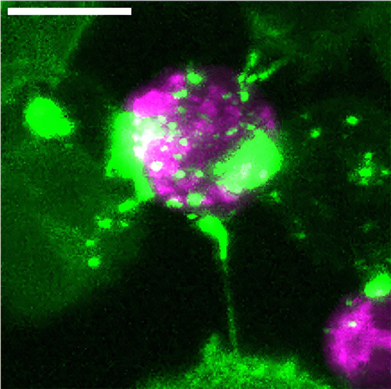 Target with potential to improve CAR T-cell therapy response in ...