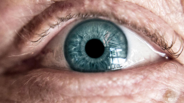 Every blue-eyed person alive traces back to a single common ancestor