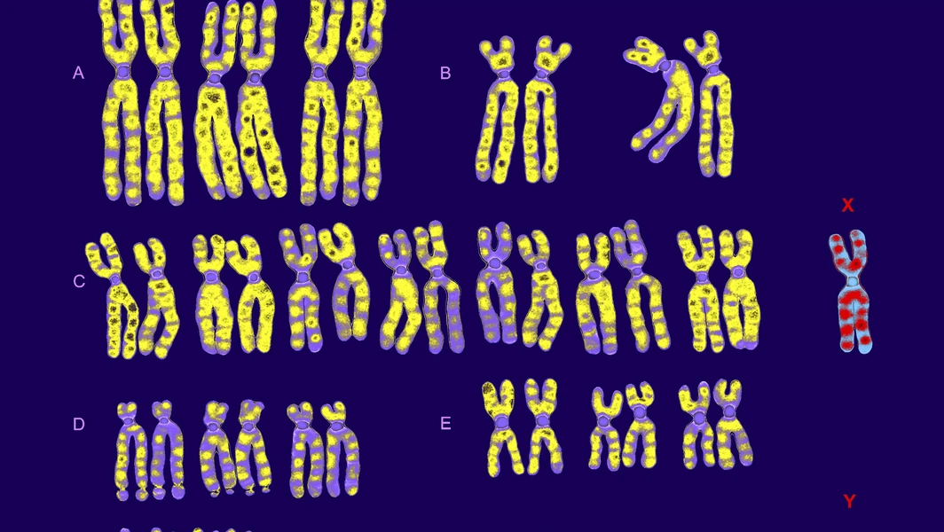 The evolution and fate of the Y chromosome