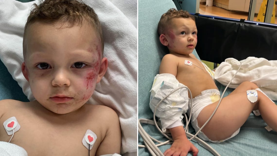 2-year-old picking up birthday cake run over in grocery store parking ...