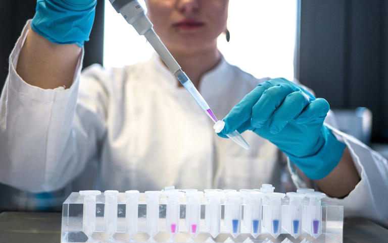 Genetic marker may flag severe IBD earlier in some patients