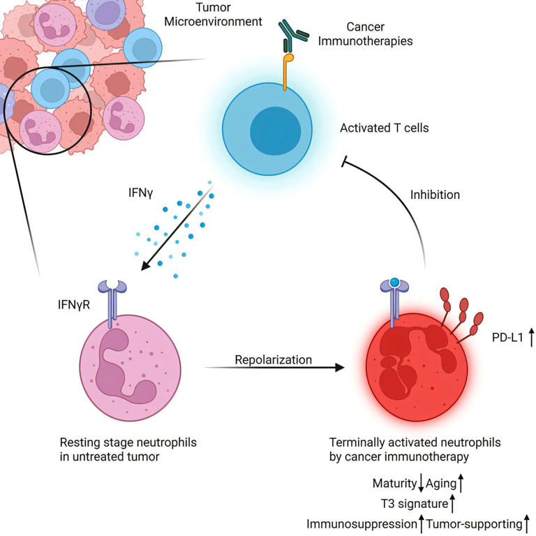Why some immunotherapy fails: Tumor-triggered neutrophils can shut down ...