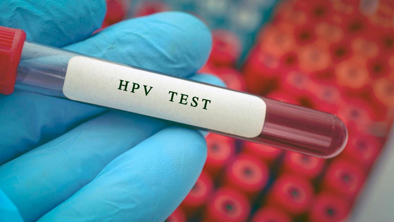 Inside India's new cervical cancer test that detects dangerous HPV ...