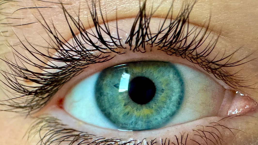 Genetics and science of rare eye colors