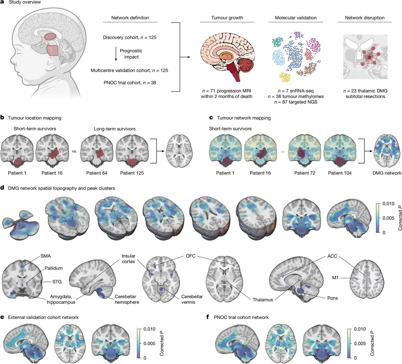 Clinician–scientists identify brain network linked to deadliest ...