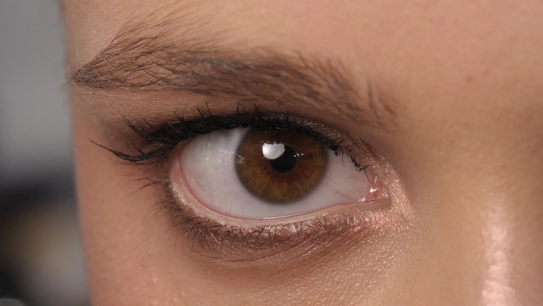 Genetics and science of rare eye colors