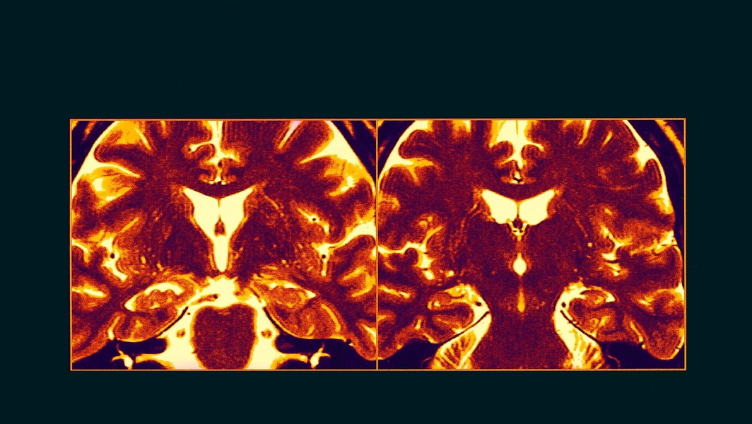 Curiosity shown to boost memory for related and unrelated facts