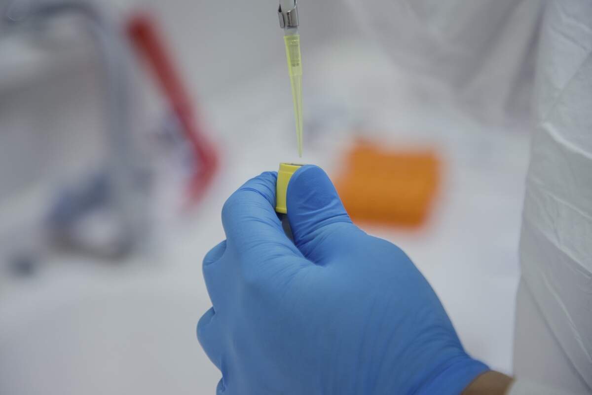 Why researchers are starting to turn bacteria into living eye drops to ...