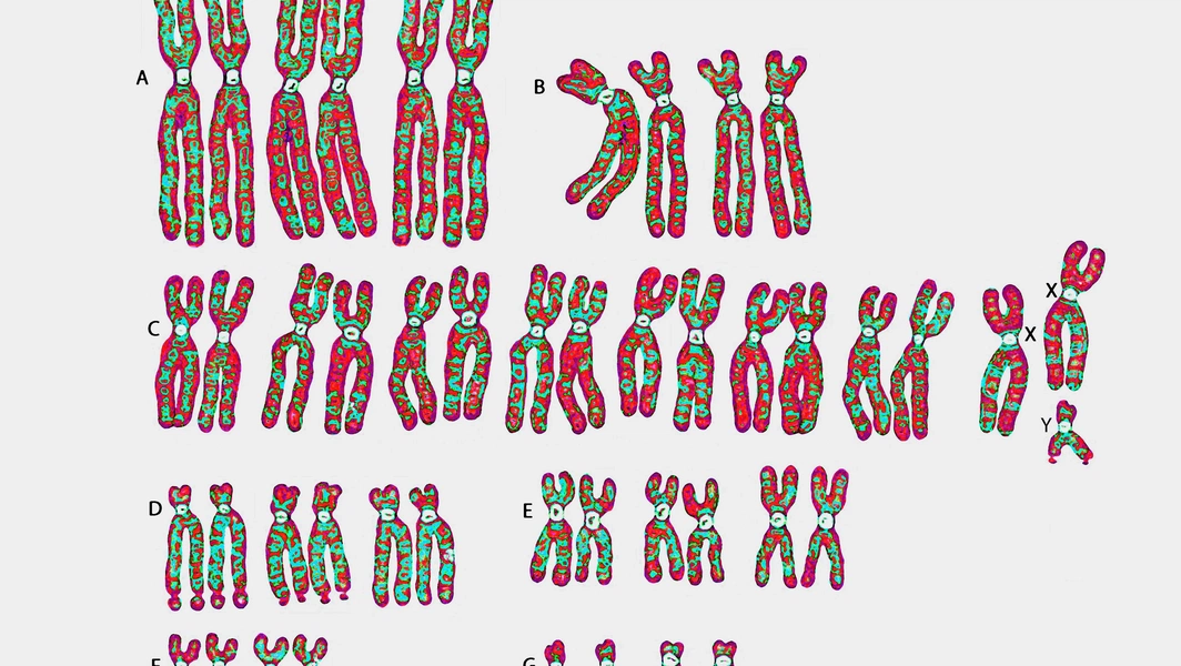 Evolution and fate of the human Y chromosome