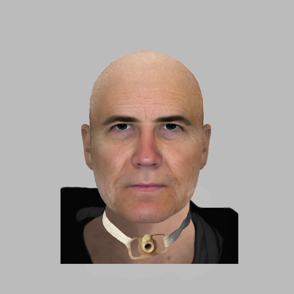 Police release e-fit of man with a tracheotomy tube wanted after a ...