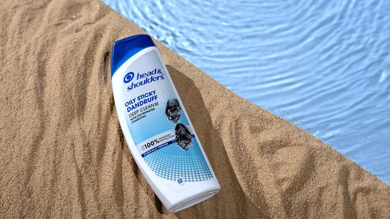 Oily sticky dandruff requires a different approach. Here's what you ...