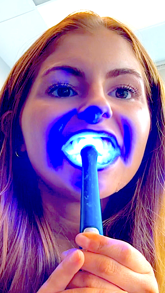 Fixing my own broken teeth