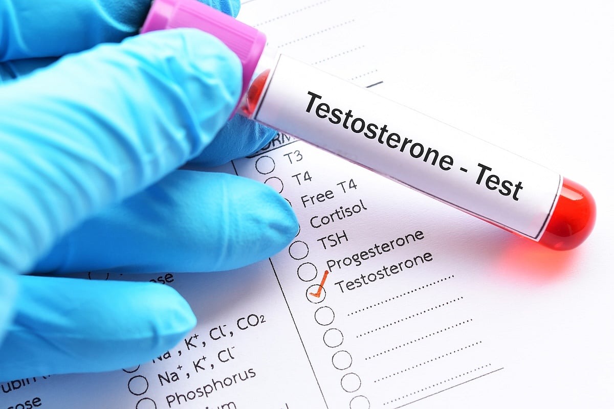 Many men are prescribed testosterone without proper testing