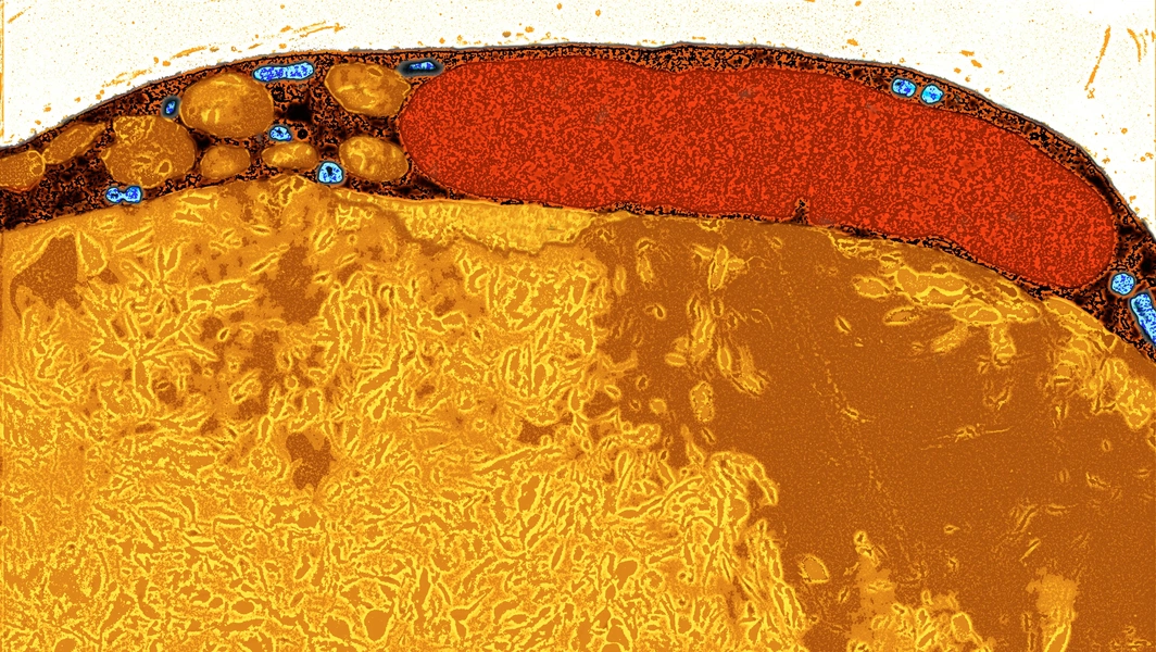 Small changes to keep triglycerides in check