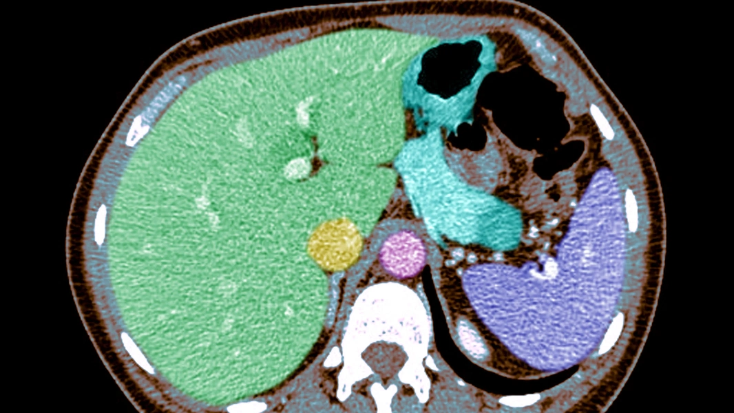 Recognizing and understanding stomach cancer