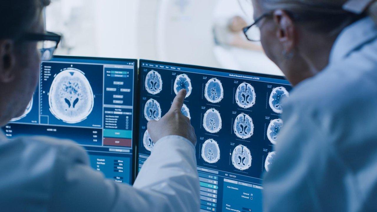 Cancer du cerveau : un facteur de risque inattendu mis en lumière