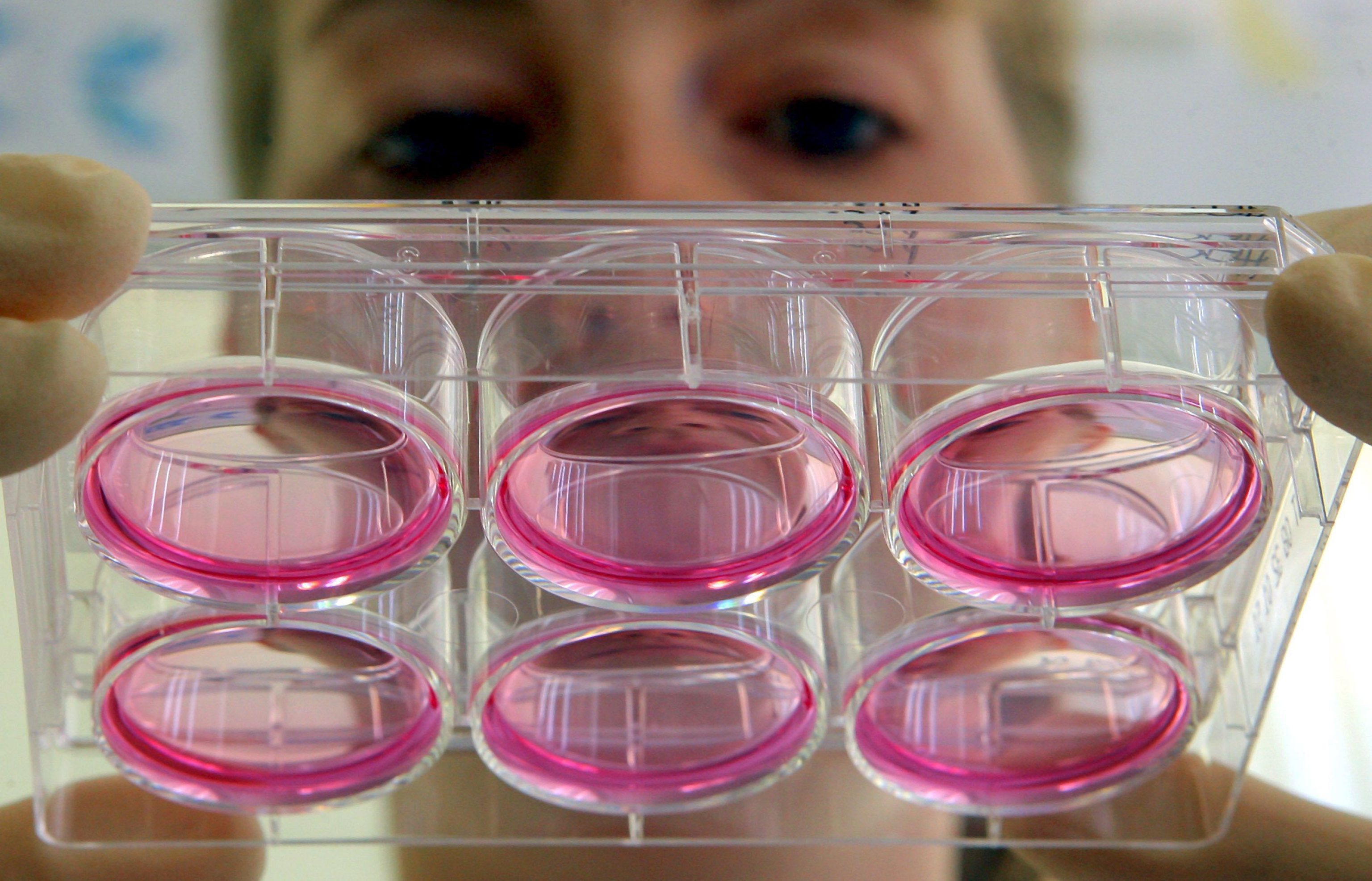 Cervello, la dopamina può alterare il senso di controllo e le decisioni