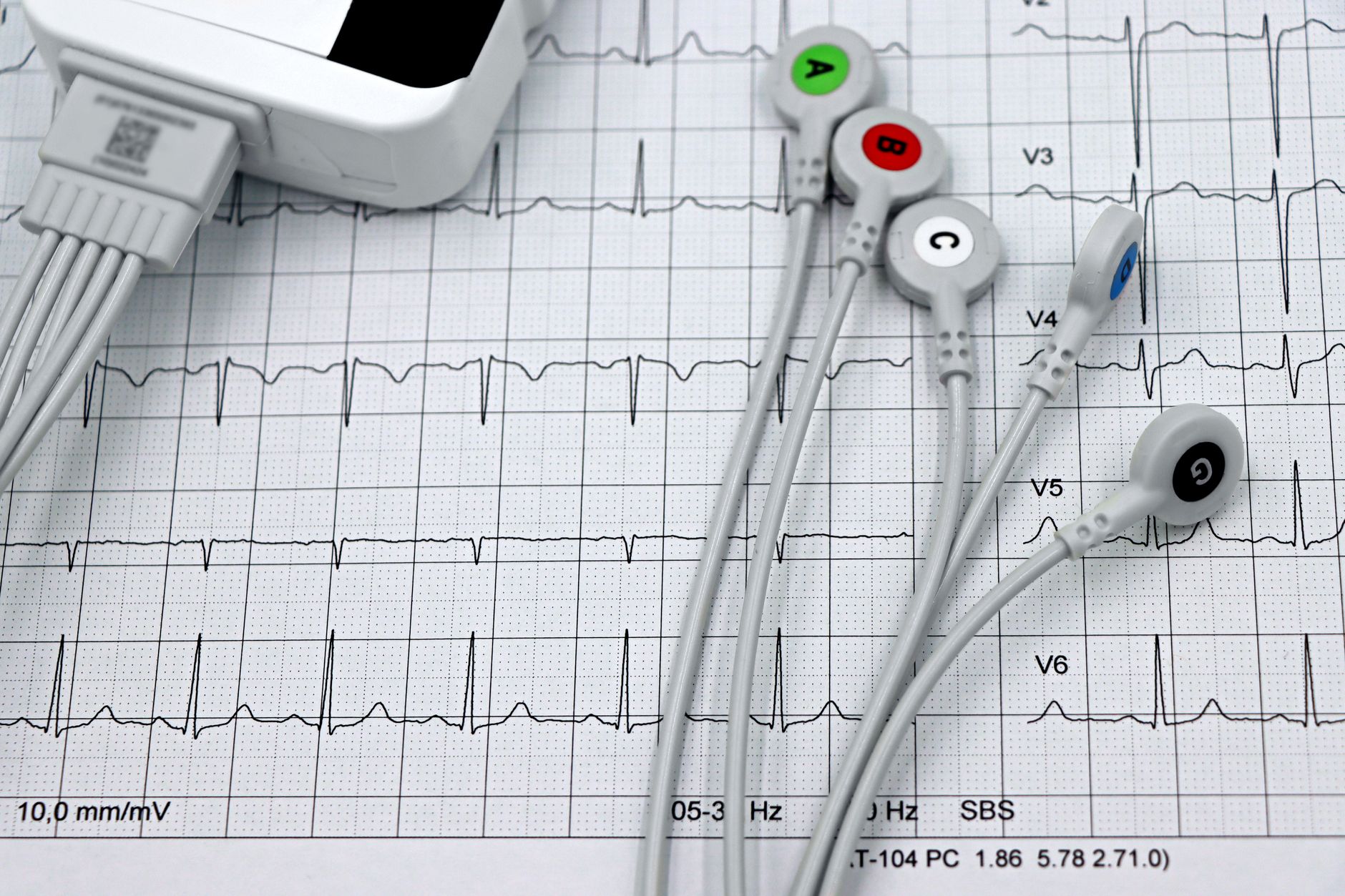 Popular drink is linked to sudden heart attacks