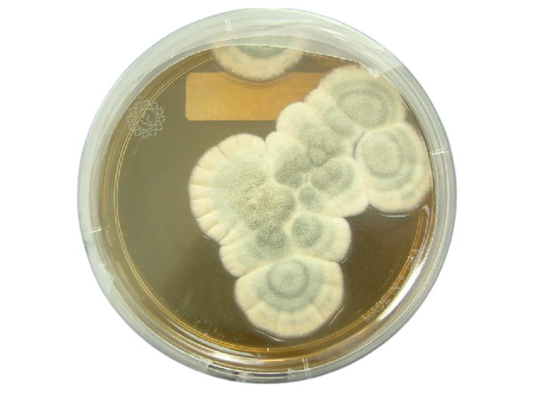 In 1928, a bacteriologist returned to a messy lab bench and found the ...