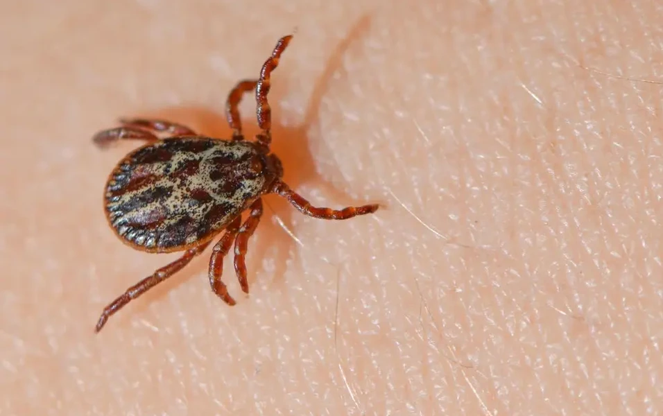 California confirms fourth-ever human case of Rickettsia lanei
