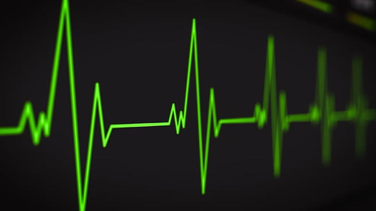 Edgewise Therapeutics reports improvements in heart drug trial